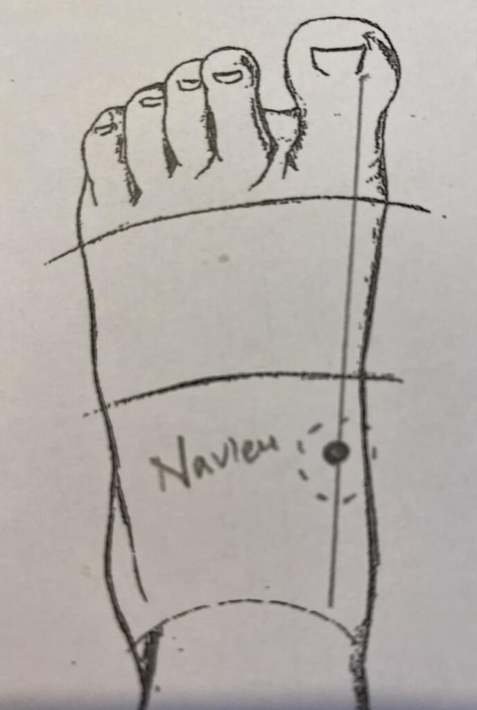 KAN DU HELLER IKKE LIDE AT BLIVE TRYKKET PÅ NAVLEN? - Maries Terapi